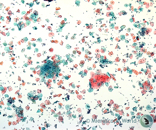 Pap Smear under the Microscope - Microscope World