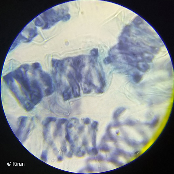 Spirogyra Microscope Microscope Slide: Spirogyra Vegetative Whole