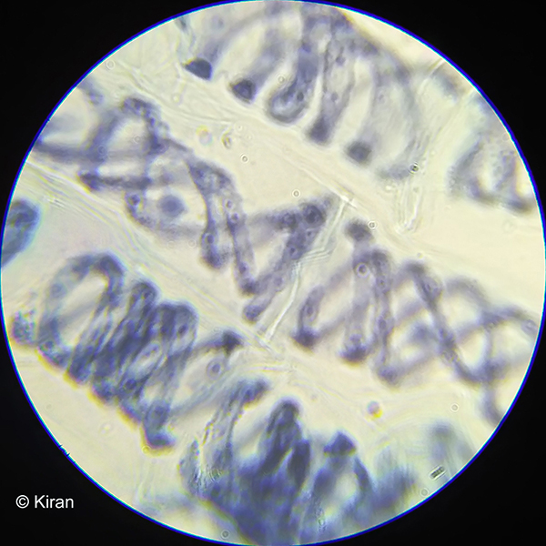 Spirogyra Slide